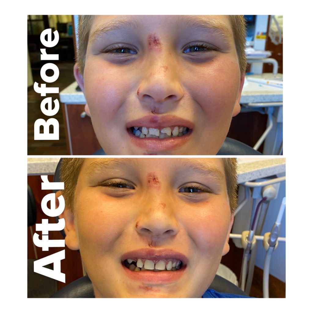 Smile Gallery - Coniglio Family Dentistry